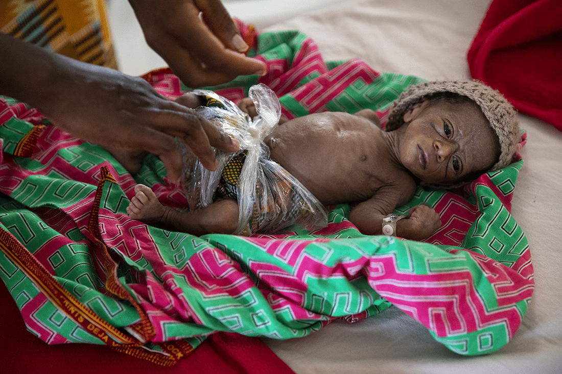 Born Too Soon: 5 Things to Know About Prematurity | Project HOPE